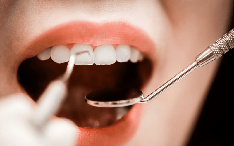 Toothache at Night in Wetherill Park – Causes & Treatment